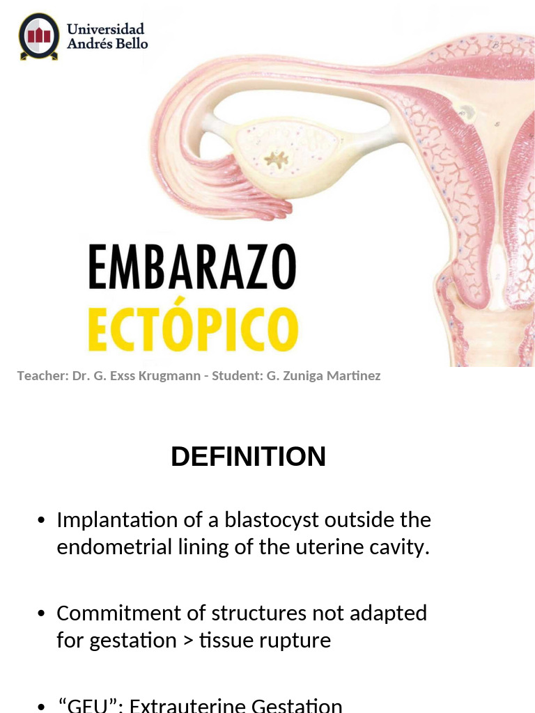 Ectopic Pregnancy: Diagnosis and Management | PDF | Medical Specialties ...