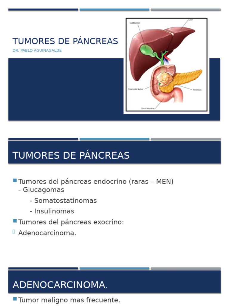 Tumores de Páncreas: Tipos y Tratamiento | PDF