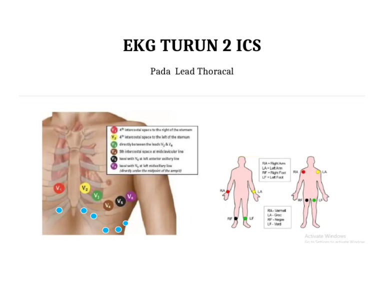 Ekg Turun 2 Ics | PDF