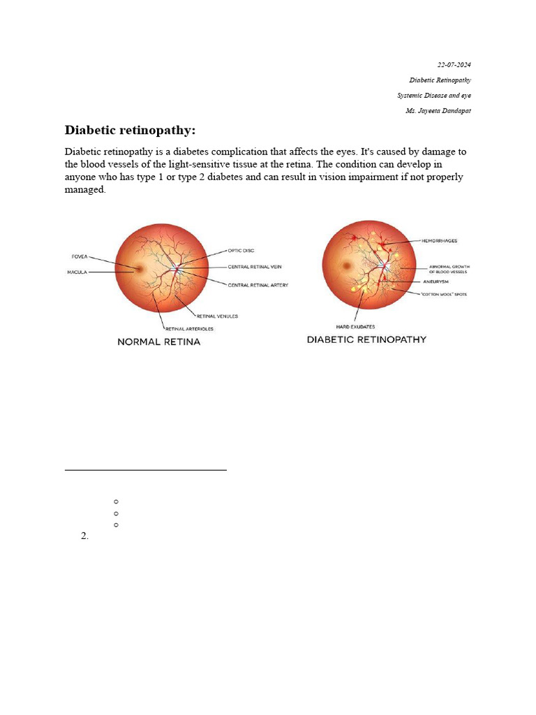 DIABETIC RETINOPATHY and Retina | PDF | Retina | Medical Specialties
