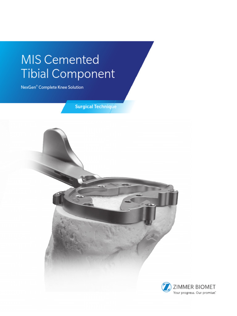 97-5950-002-00 REV4-0916 NexGen MIS Tibial Component Cemented Surgical Technique-FINAL | PDF ...