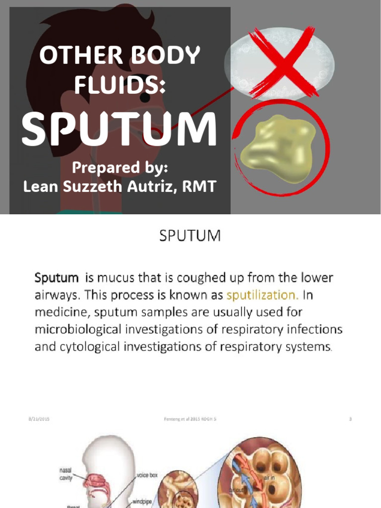 AUBF LAB - Sputum | PDF