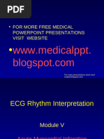 STEMI 12 Lead ECG Analysis Guide | PDF | Electrocardiography | Visual ...