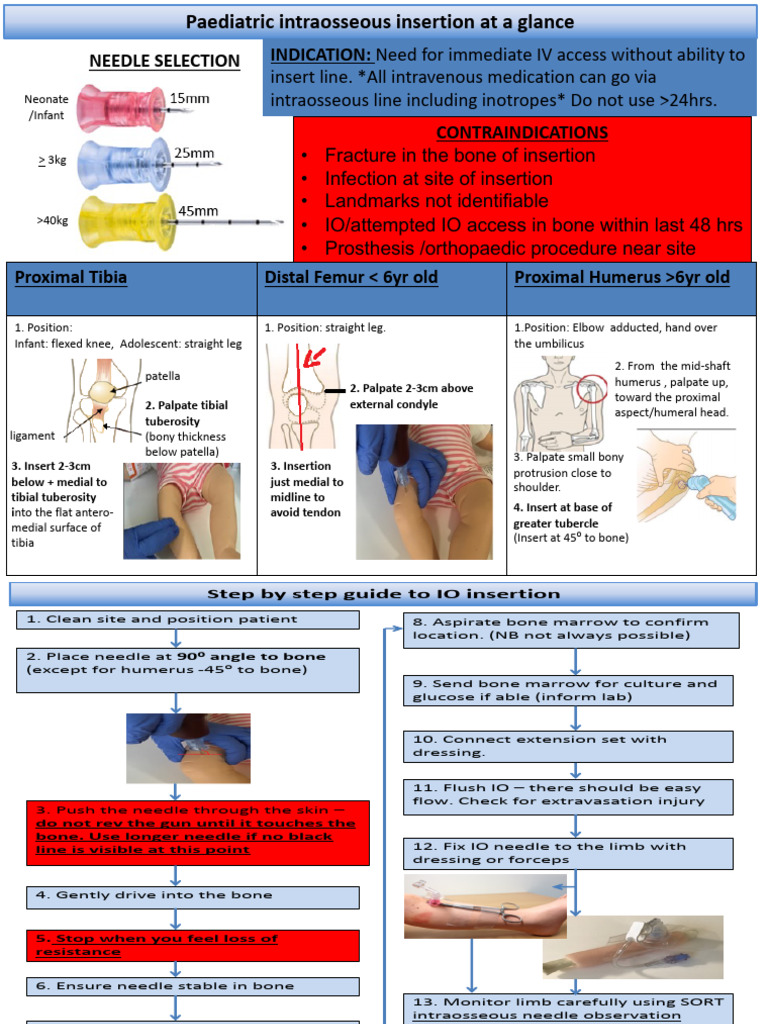 Intraosseous IO Insertion Guide | PDF | Musculoskeletal System ...