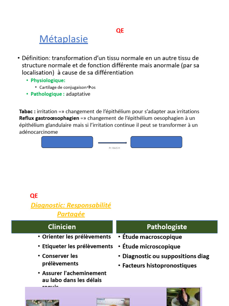 Métaplasie et Diagnostic Tumoral | PDF | Oncogène | Cancer