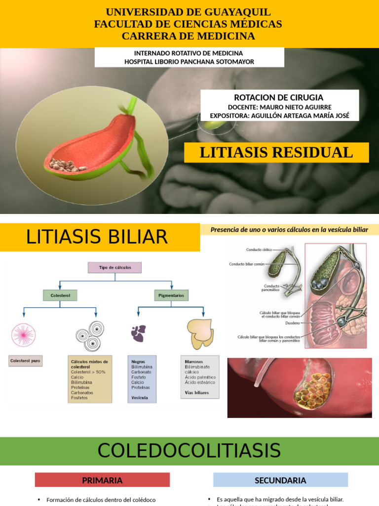 LITIASIS BILIAR | PDF | Hígado | Enfermedades y trastornos
