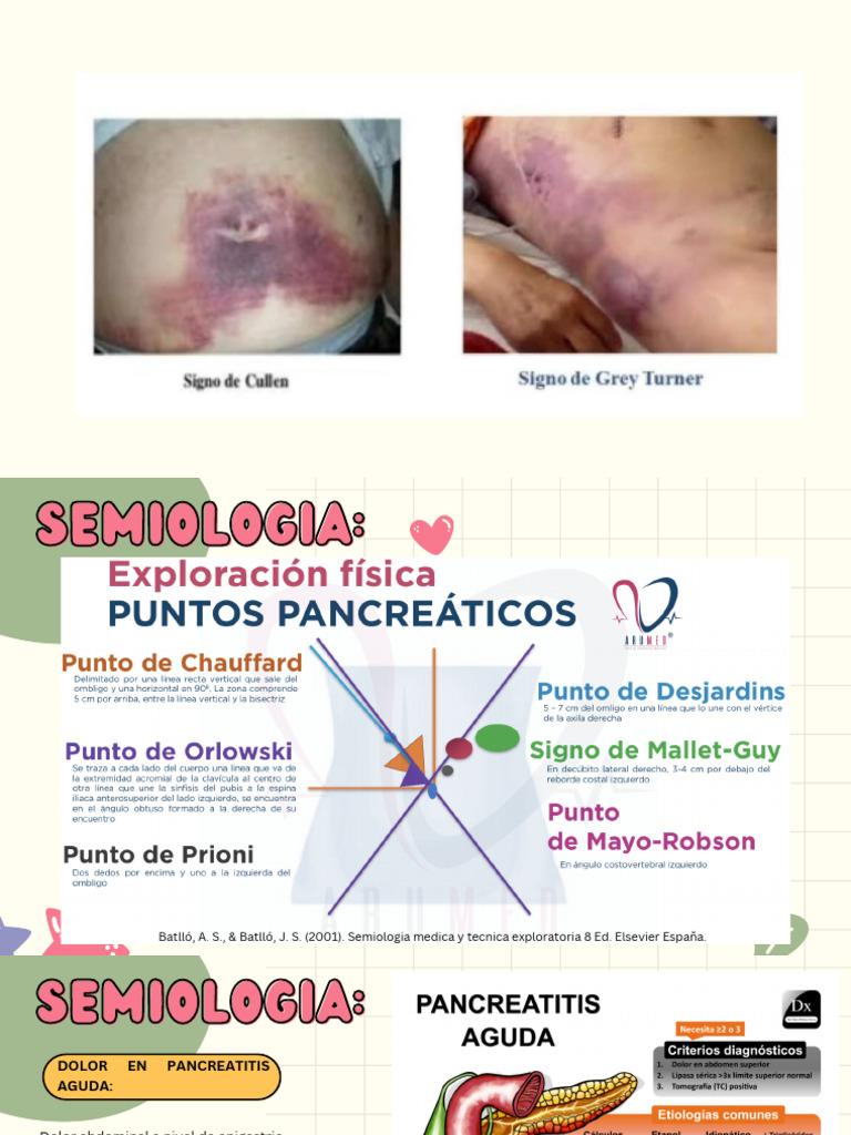 Dolor Epigástrico en Pancreatitis Aguda | PDF