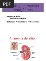 Síndrome de Potter | PDF | Epidemiología | Medicina