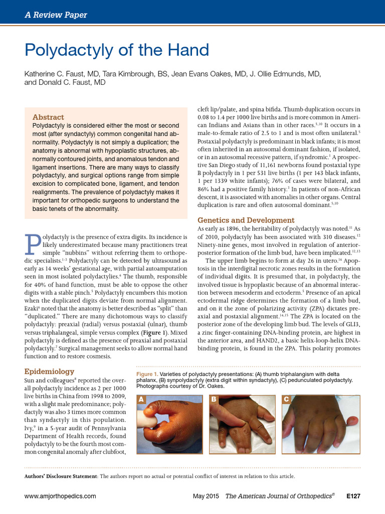 Polydactyly of The Hand PDF | PDF | Thumb | Hand