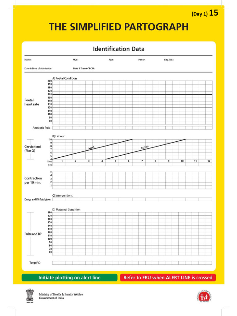 Partograph Simplified Ind | PDF