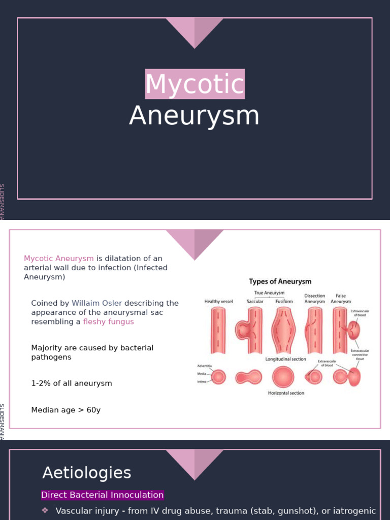 Mycotic Aneurysm: Causes and Management | PDF | Interventional ...