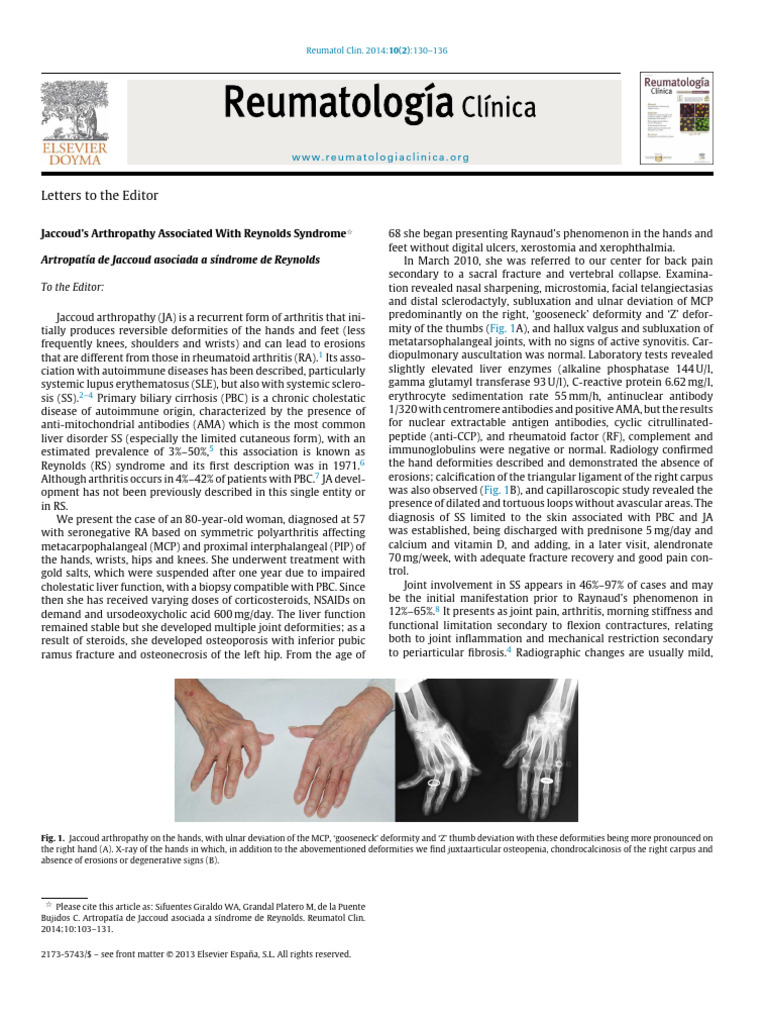Jaccoud's Arthropathy Associated With Reynolds Syndrome | PDF ...