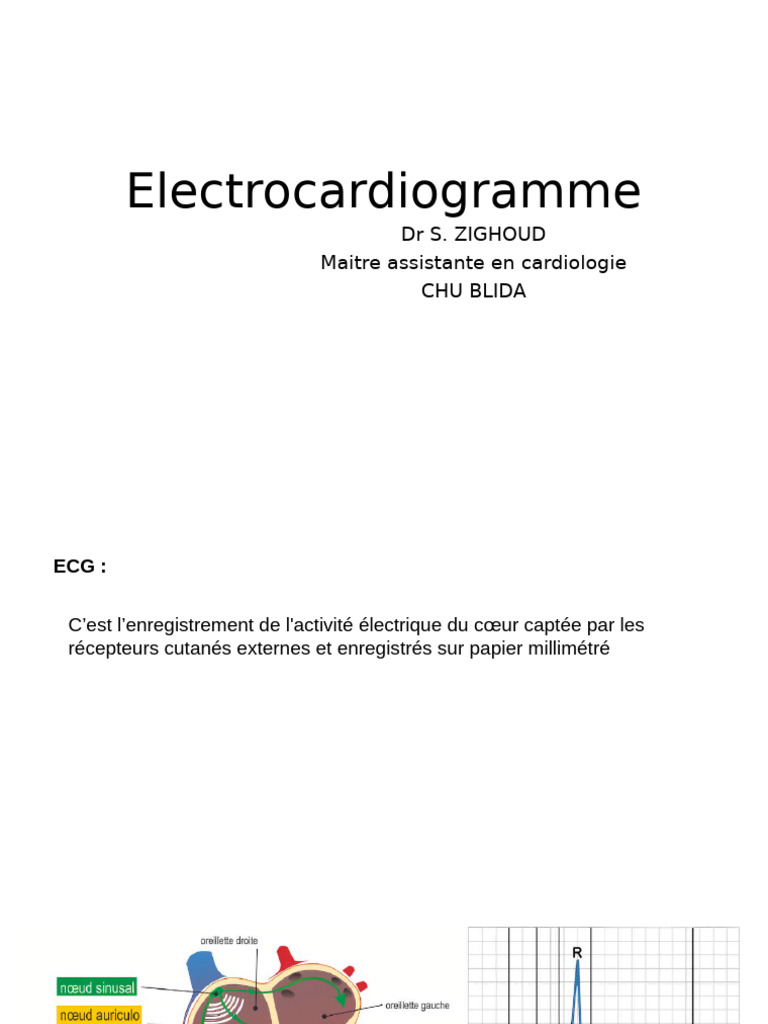 Guide Pratique de l'ECG | PDF | Électrocardiographie | Médecine clinique