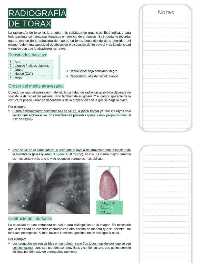 Radiografía de Torax (Semiología), Interpretación Básica | PDF | Pulmón | Rayo X