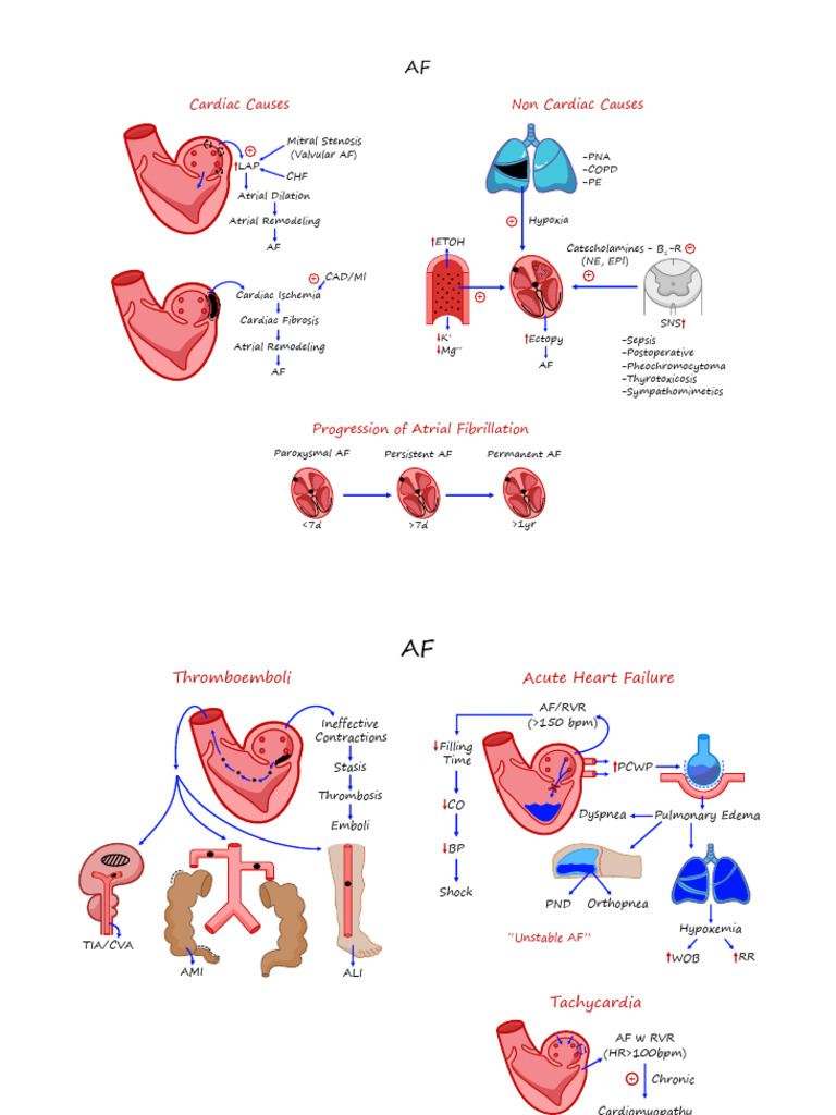Atrial Fibrillation Progression and Causes | PDF | Heart | Heart Failure