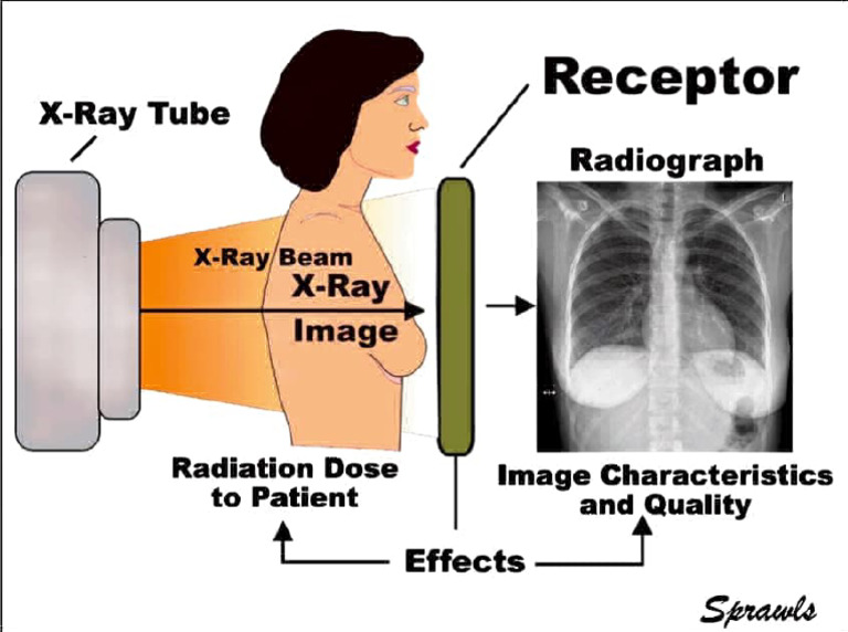 Radiographic Receptor | PDF