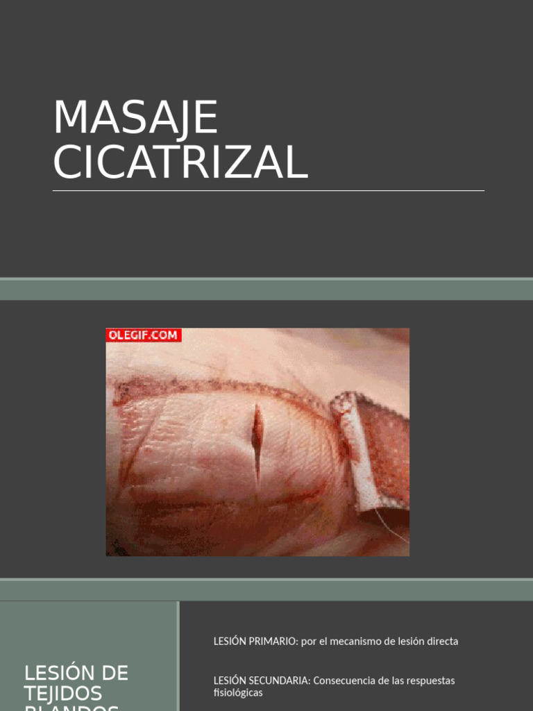 MASAJE CICATRIZAL | PDF | Cicatriz | Inflamación