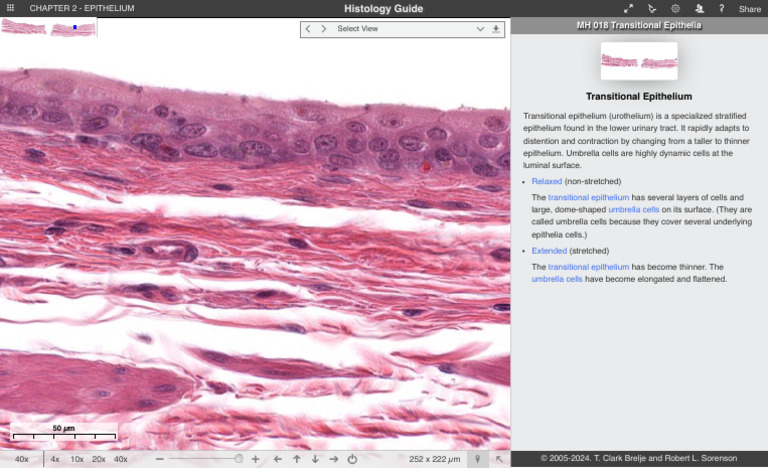 Transitional Epithelium Epithelium 2 | PDF