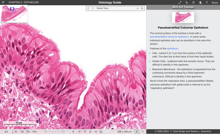 Pseudostratified Columnar Epithelium Epithelium | PDF | Epithelium ...