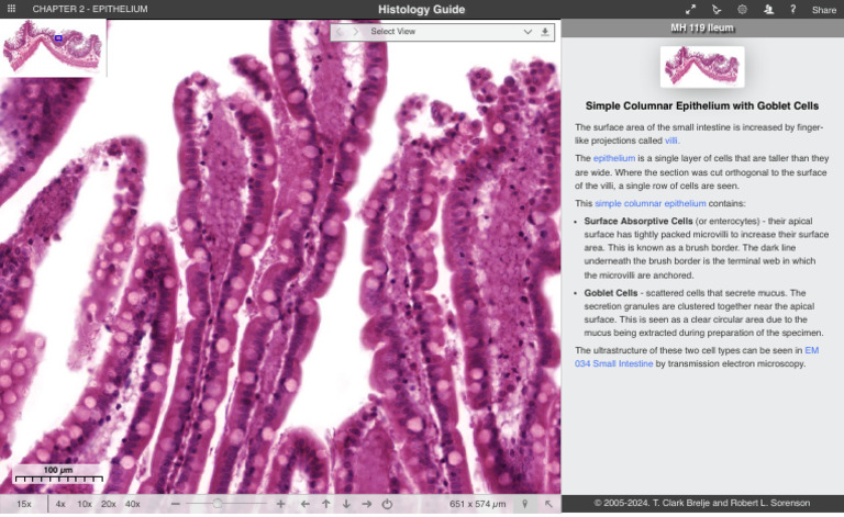 Simple Columnar Epithelium Histology Guide | PDF | Epithelium | Small ...