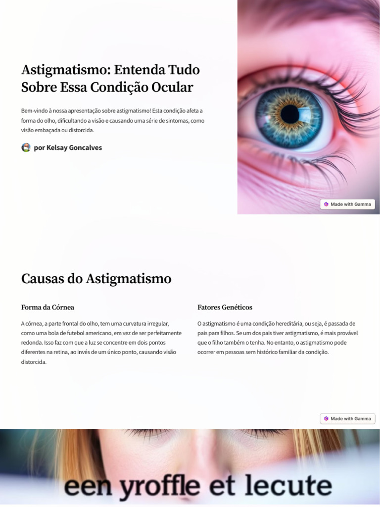 Astigmatismo Entenda Tudo Sobre Essa Condicao Ocular | PDF | Sistema ...