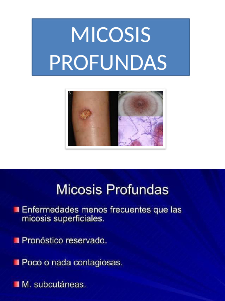 Micosis Profundas: Guía Completa | PDF