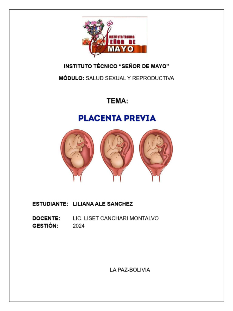 Placenta Previa: Definición y Tratamiento | PDF | El embarazo | Placenta