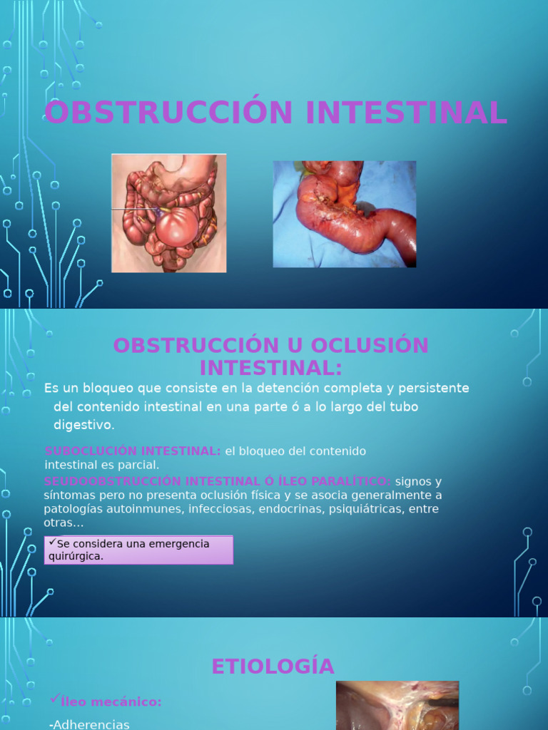 Obstruccion Intestinal (1) | PDF | Especialidades Medicas ...