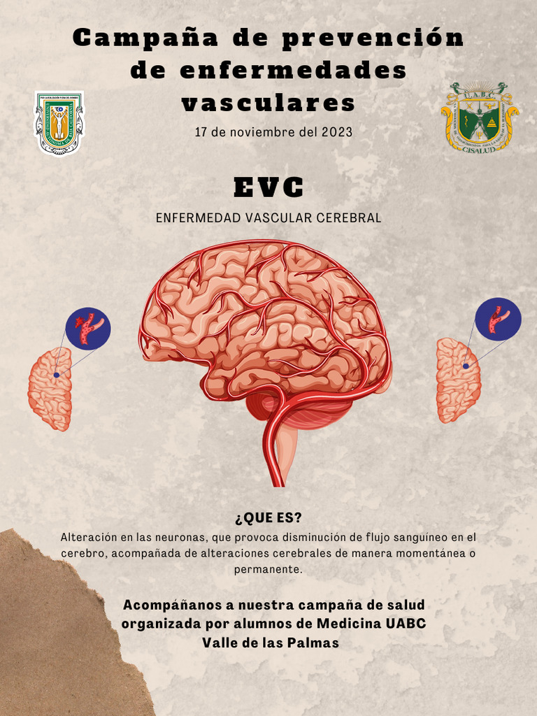 Flyer EVC | PDF