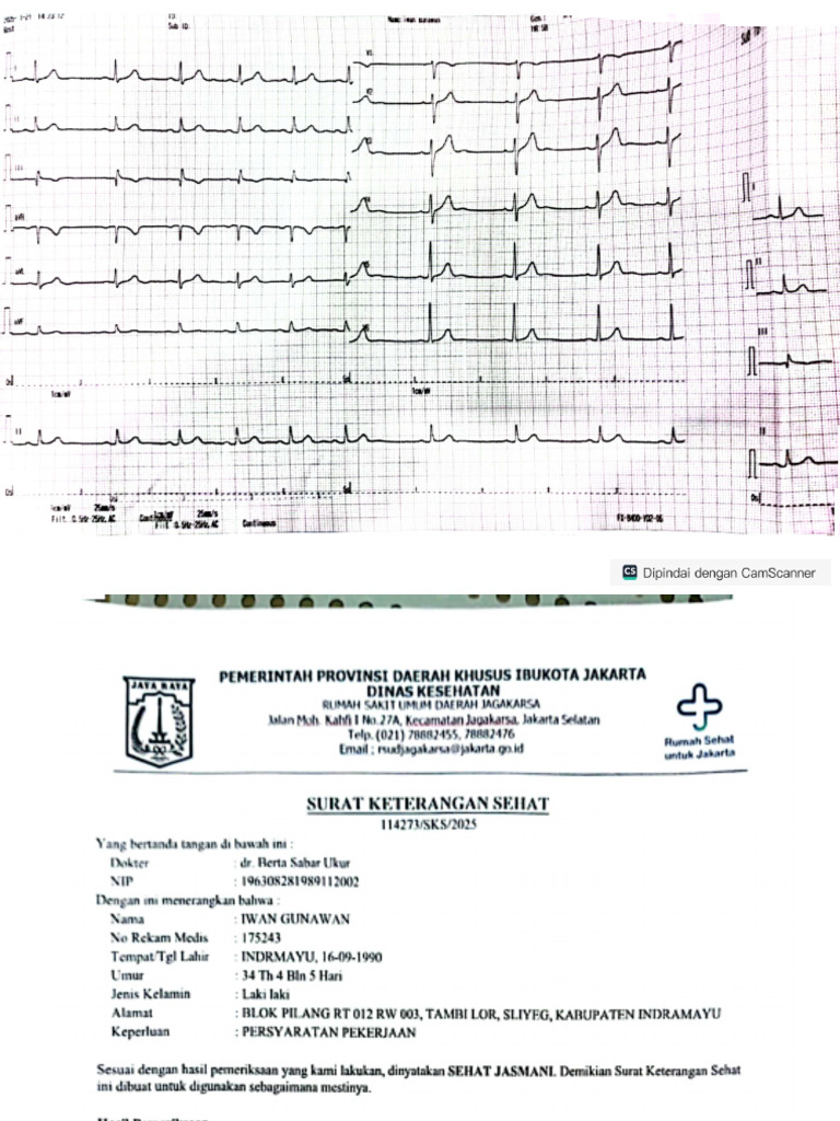 EKG | PDF