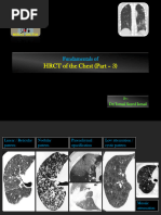 HRCT Chest Basic Interpretation | PDF | Lung | Medical Specialties
