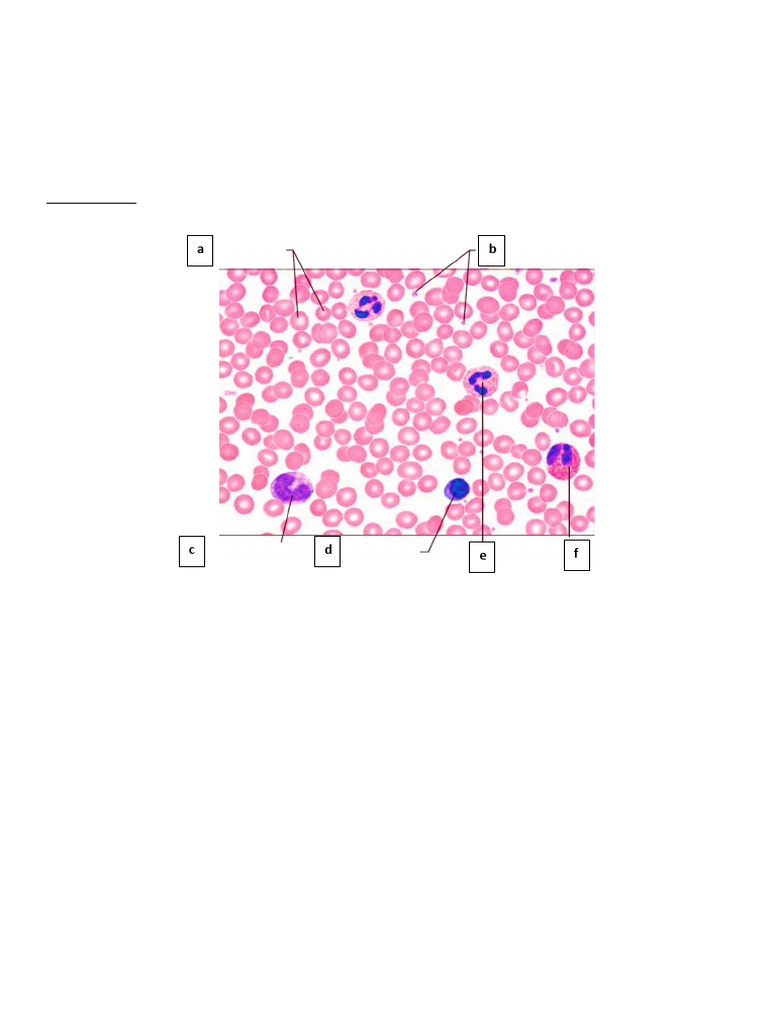 APP 8th Lab. Activity (Cardiovascular System Blood and Heart) | PDF ...