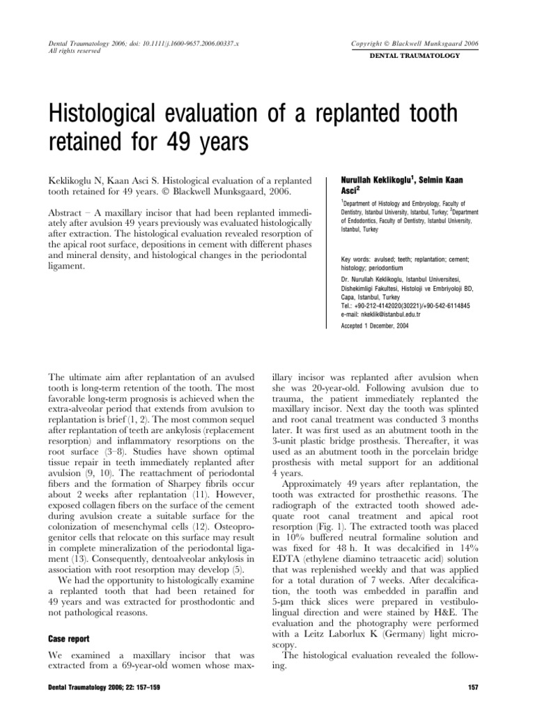 Traumatic Intrusion of Permanent Teeth. Part 2. | PDF | Medical ...