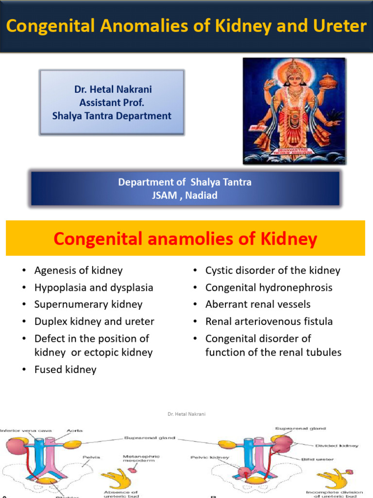 Congenital Anomalies of Kidney and Ureter | PDF | Kidney | Urological ...