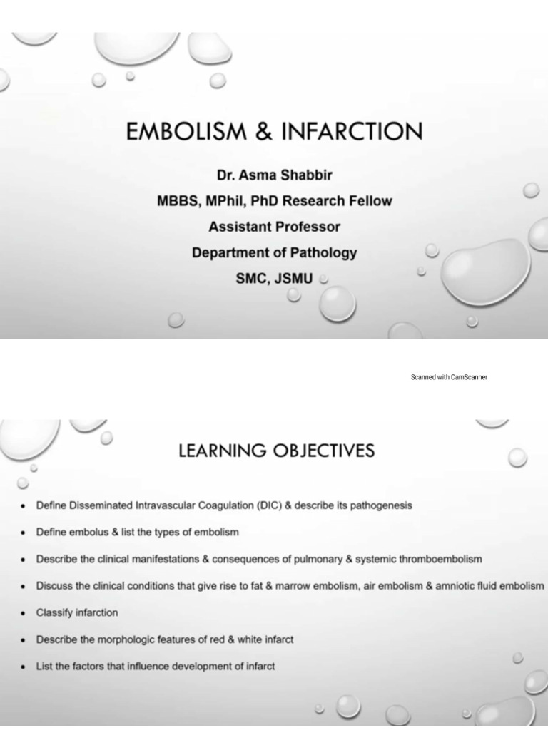 Embolism and Infarction | PDF