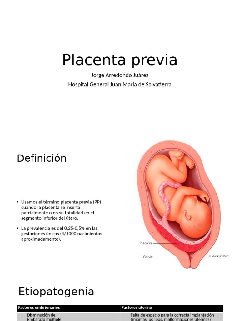 Placenta Previa | PDF | Placenta | Medicina CLINICA