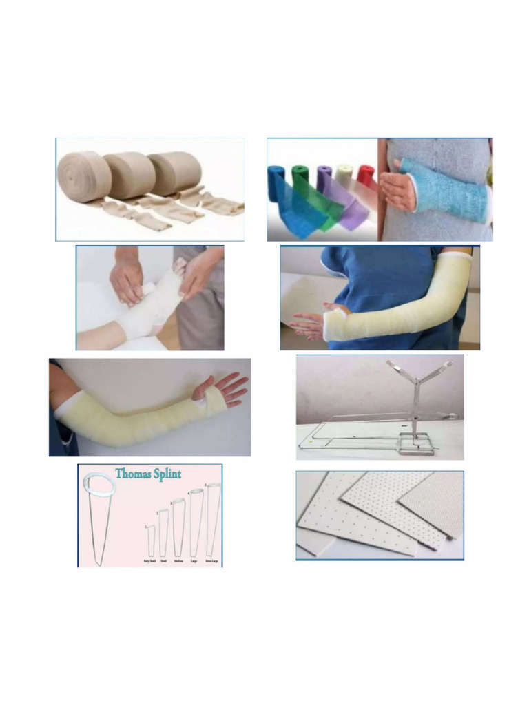 Splint and Cast and Ambulation | PDF