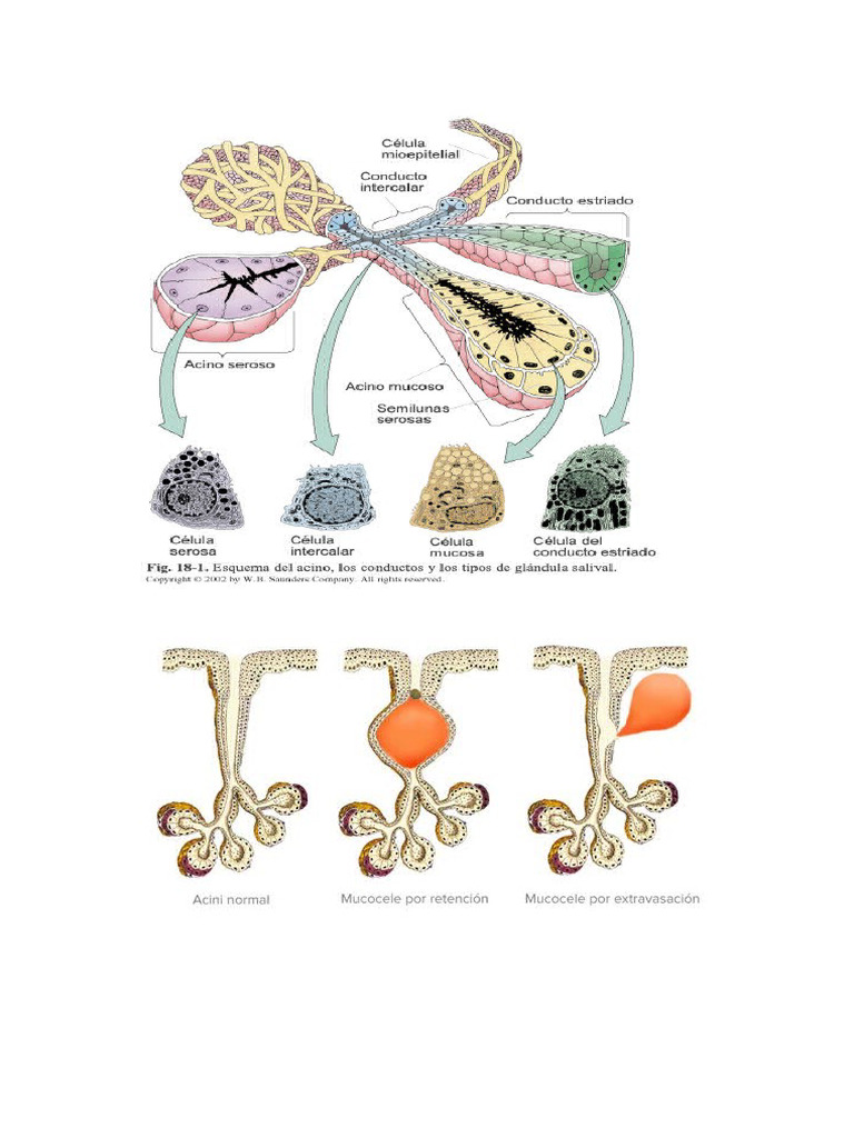 DIBUJOS PATOLOGIA ORAL Sialona | PDF