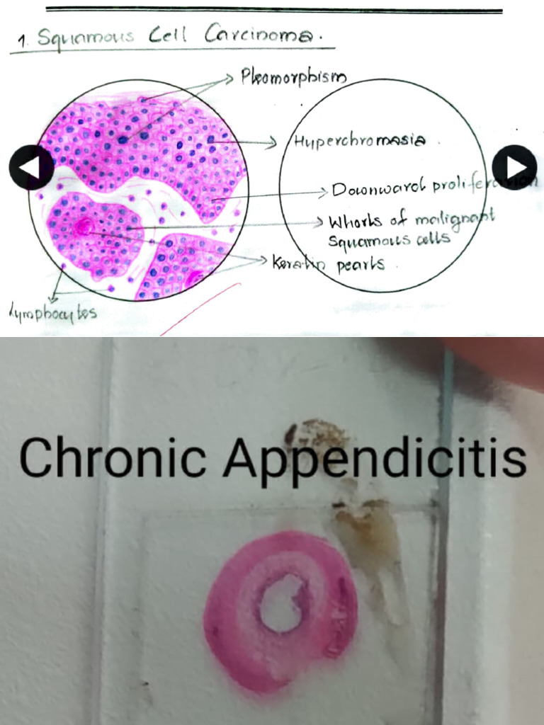Slides Pathology | PDF