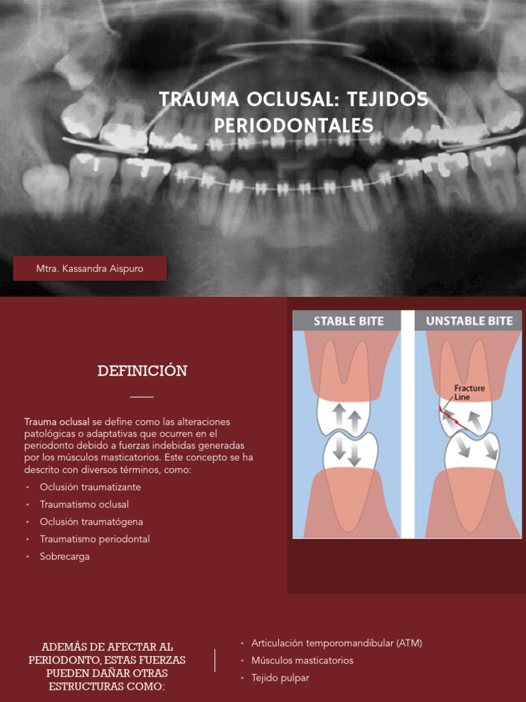 Trauma Oclusal y Tejidos Periodontales | PDF | Odontología | Ramas de ...