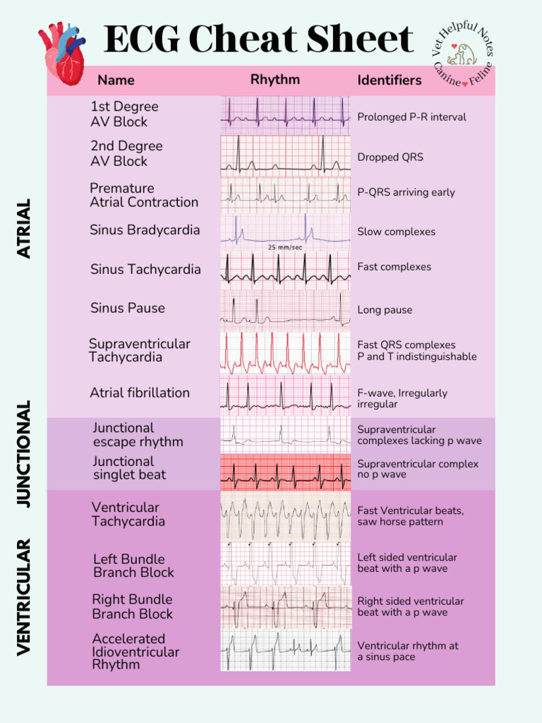 ECG Rhythm Identification Guide | PDF