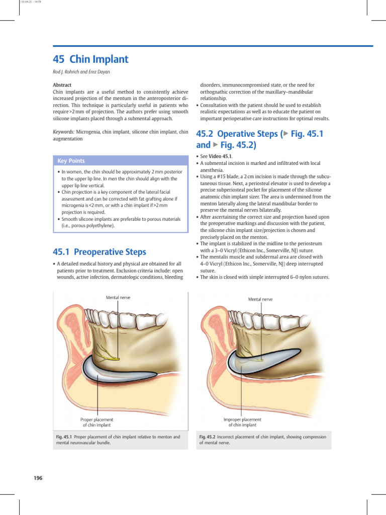 Chin-Implant | PDF | Surgery | Surgical Specialties