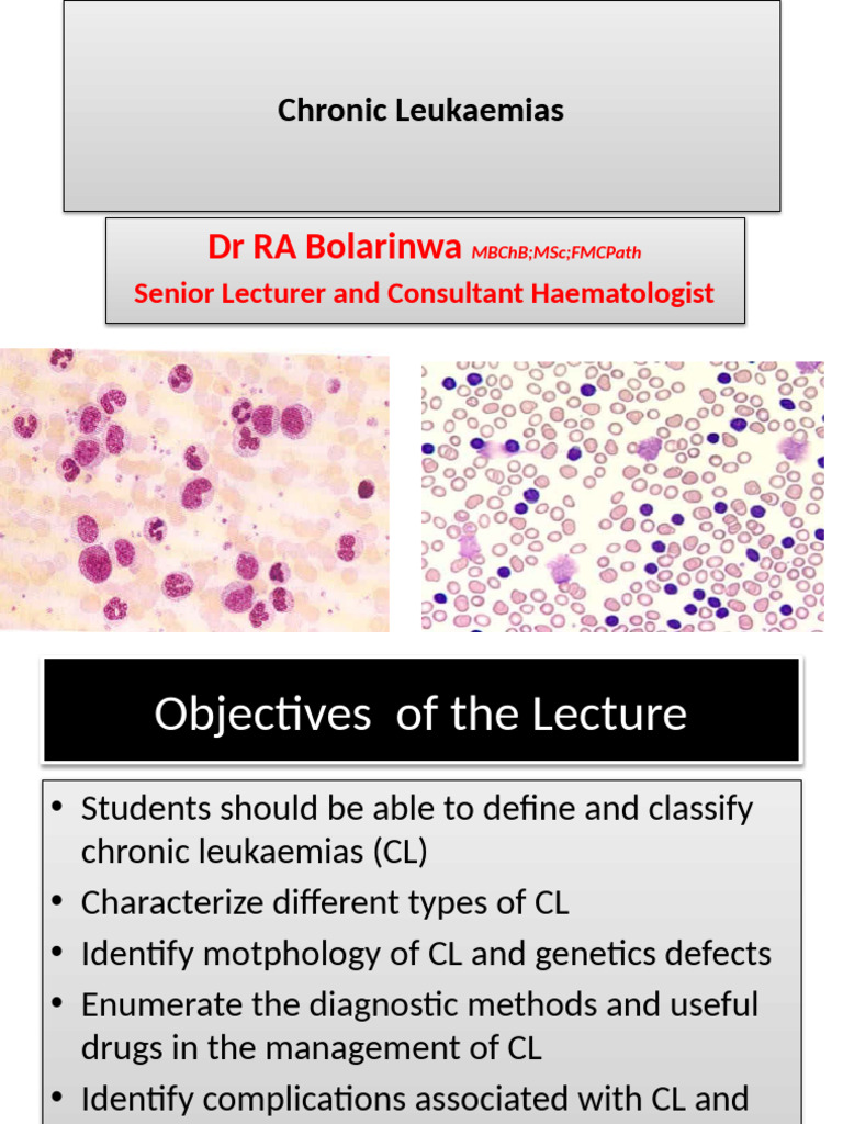 Chronic Leuk - Student Lec - 2021 | PDF | Leukemia | B Cell