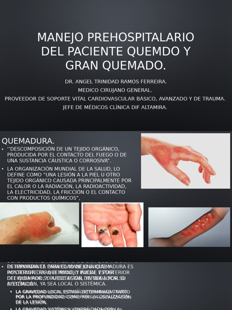 Gran Quemado | PDF | Quemar | Choque (circulatorio)