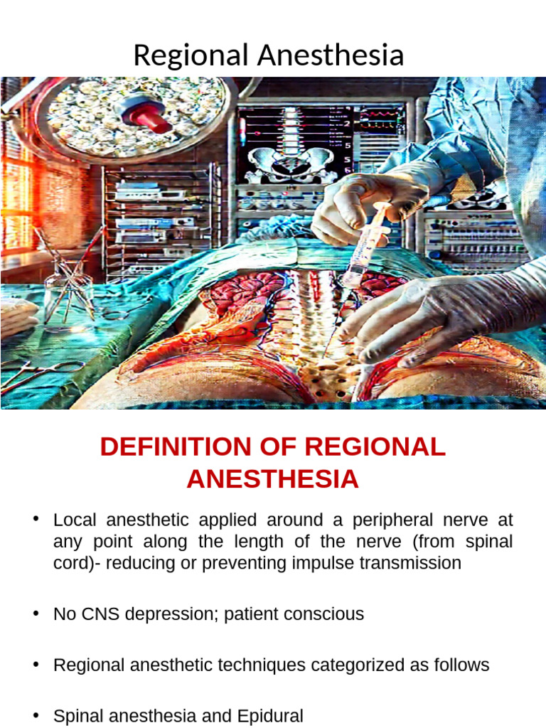 Understanding Regional Anesthesia Techniques | PDF | Anesthesia ...