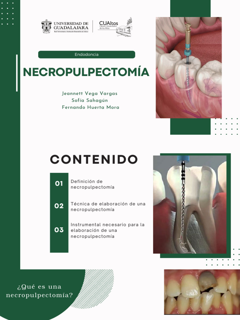 Necropulpectomía | PDF | Medicina CLINICA | Especialidades Medicas