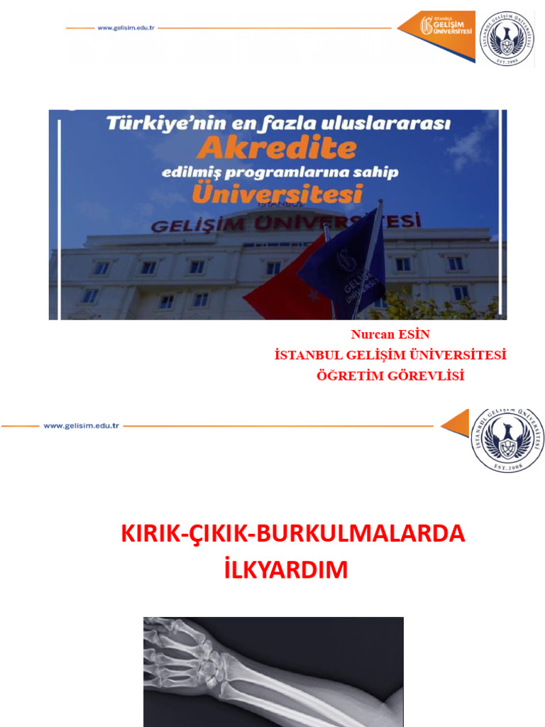 10 Kirik Cikik Burkulma | PDF