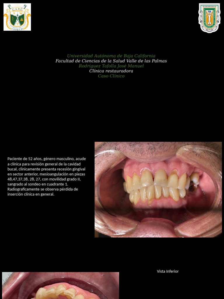 Caso Clinico Bernardo | PDF