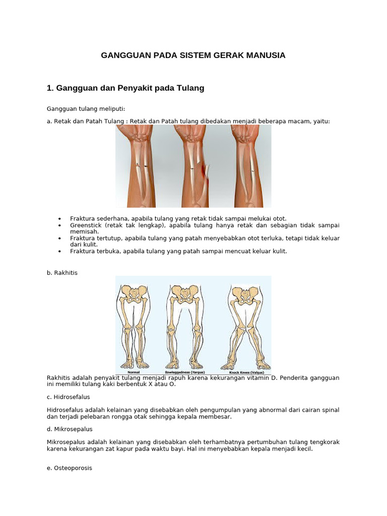 Gangguan Sistem Gerak Manusia | PDF