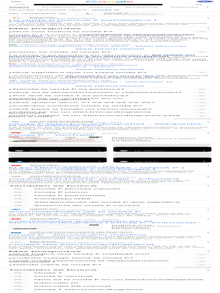 Ondap - Buscar Con Google | PDF | Electrofisiologia | Corazón